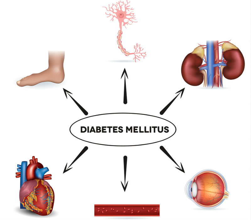 Type 2 Diabetes Mellitus (T2DM): What It Is & How to Prevent It | Barix