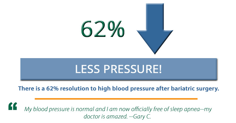 Less Pressure | Barix